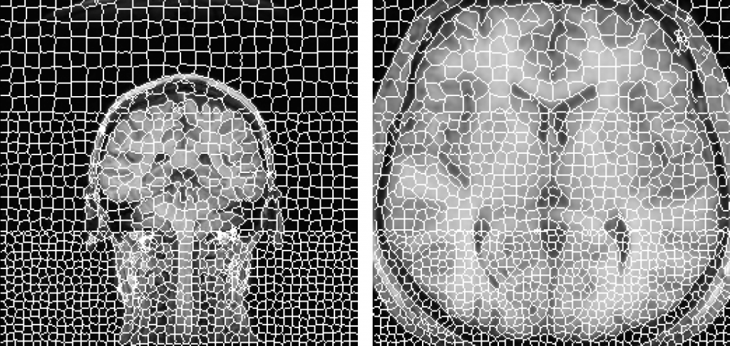 image Superpixels in Brain MR Image Analysis – UT Biomedical ...