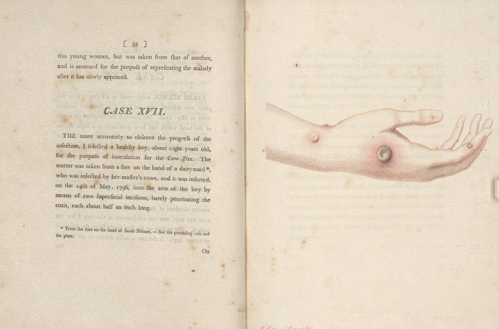 Contemporary debates on vaccination policies have historical parallels ...