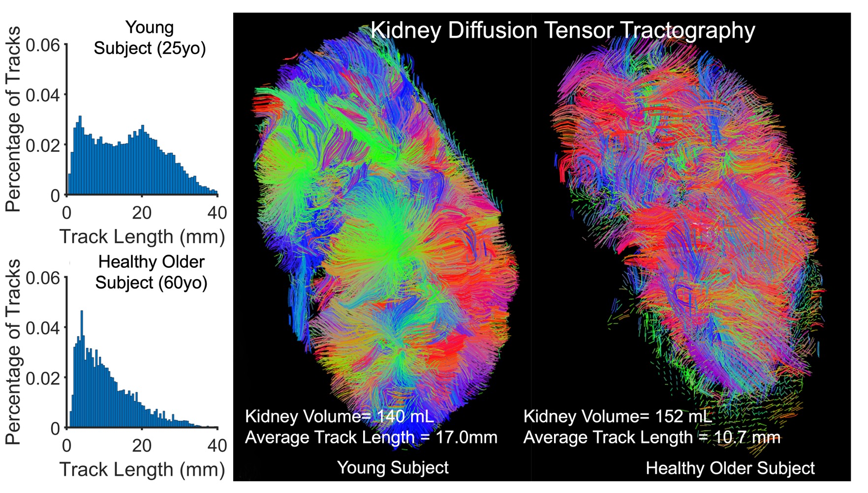 Research – Translational Cardiovascular Imaging Laboratory